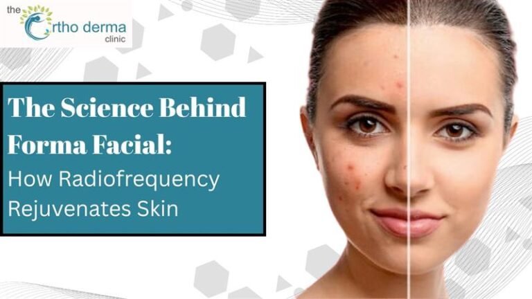 The Science Behind Forma Facial | RF Skin Rejuvenation