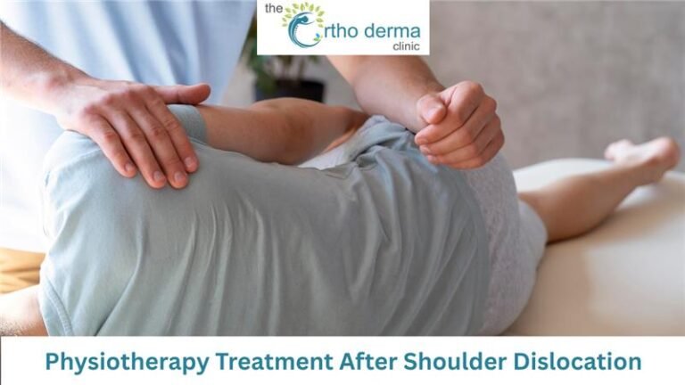 Physiotherapy for Shoulder Dislocation Recovery » Orthodermaclinic