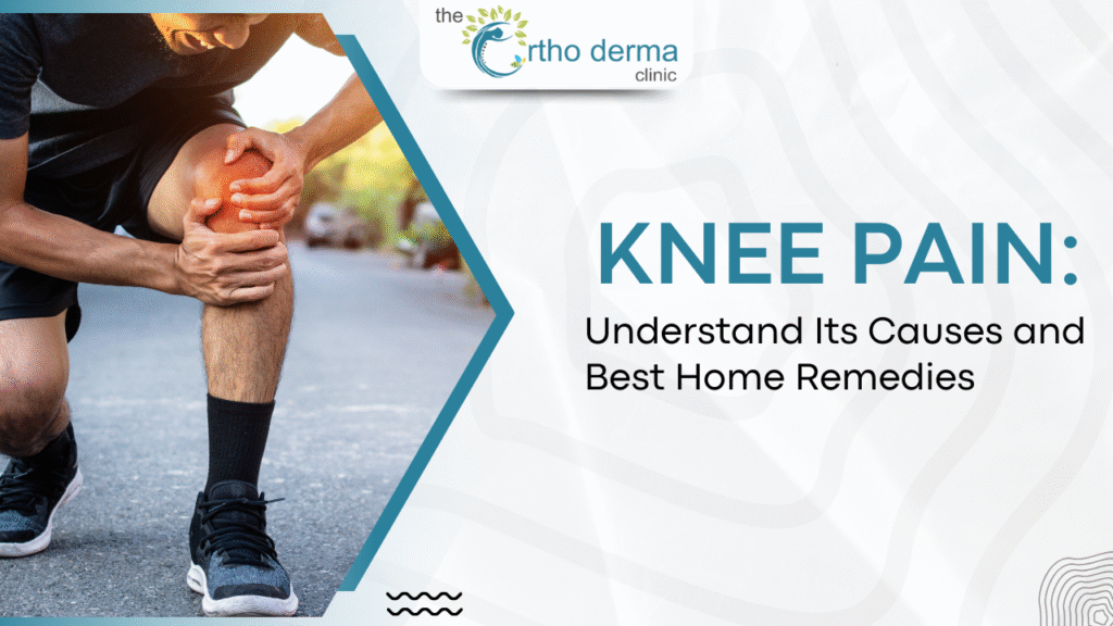 Guide to Understanding Knee Pain and Home Remedies » Orthodermaclinic
