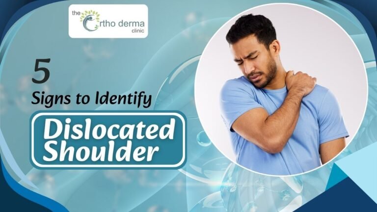 Top 5 Warning Signs of a Dislocated Shoulder | Expert Guide ...